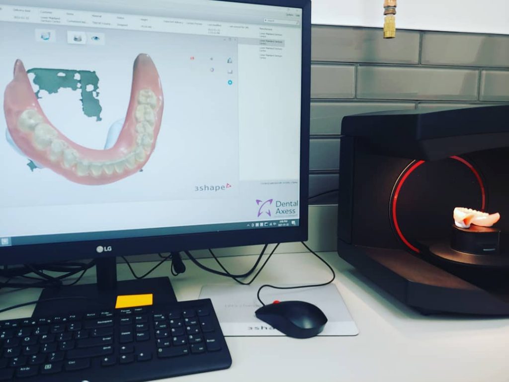 Digital Dentures! - Lower Mainland Denture Clinic